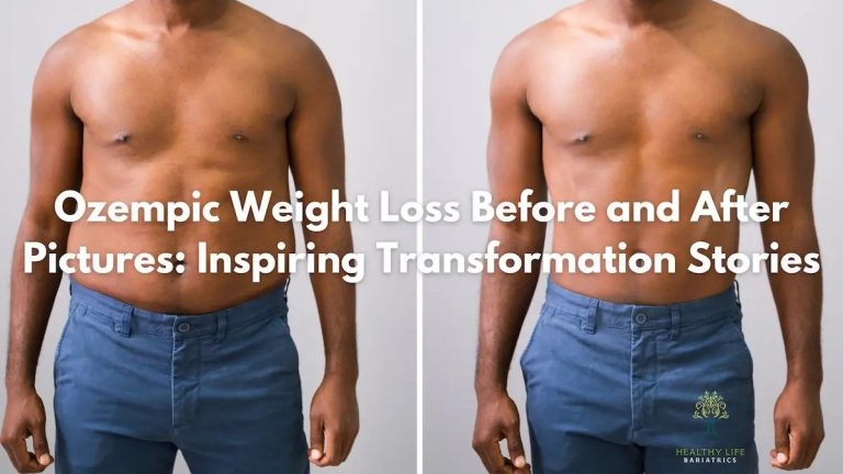 Ozempic Weight Loss Process Archives - Healthy Life Bariatrics