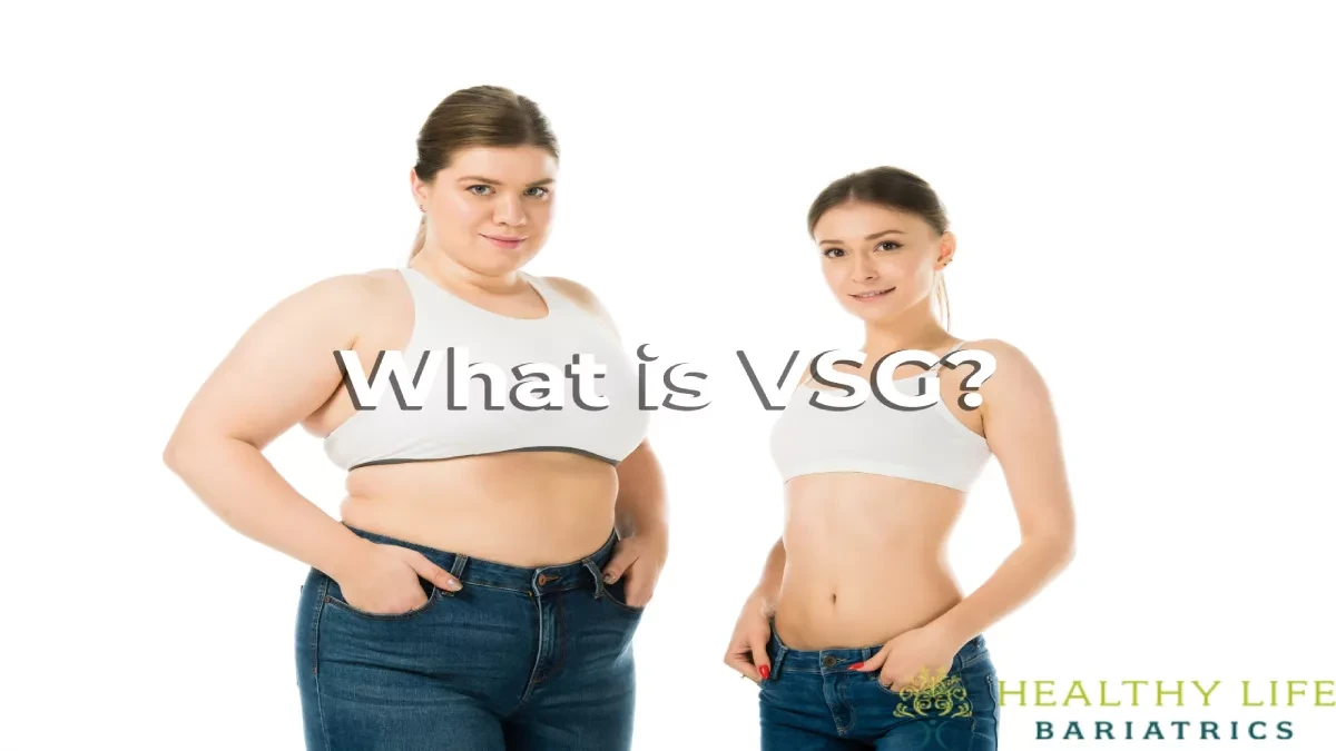 What is VSG Surgery? | Vertical Sleeve Gastrectomy LA